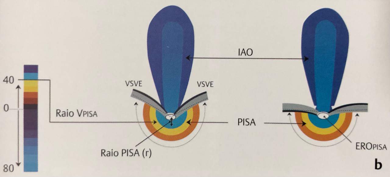 Insuficiência Aórtica: aspectos ecocardiográficos - Blog Ecope