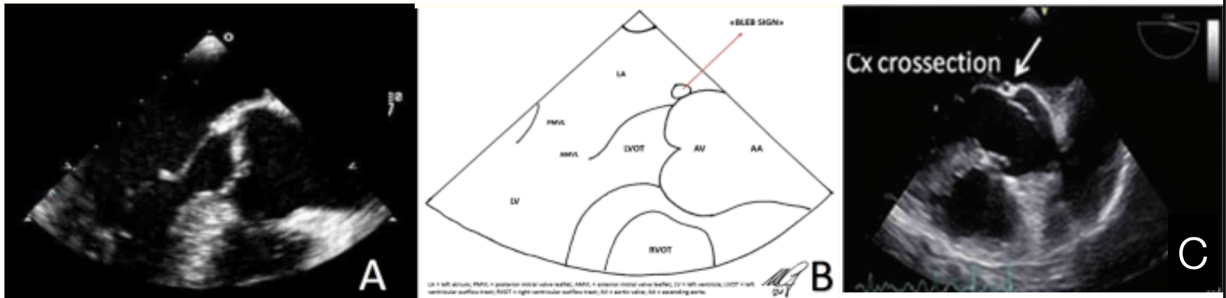 Já ouviu falar em “RAC Sign”? - Blog Ecope