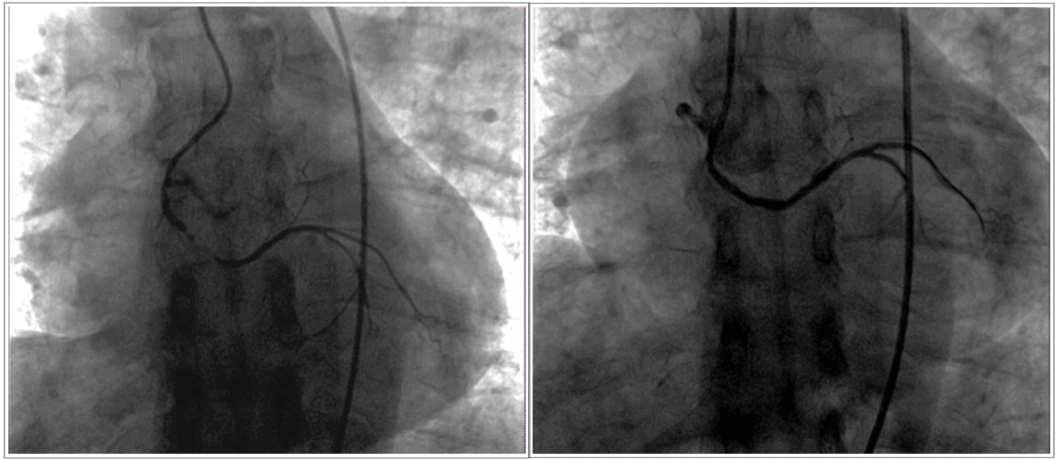 Já ouviu falar em “RAC Sign”? - Blog Ecope