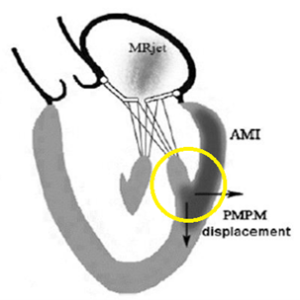 Tethering e Tenting – definições e aplicações clínicas - Blog Ecope