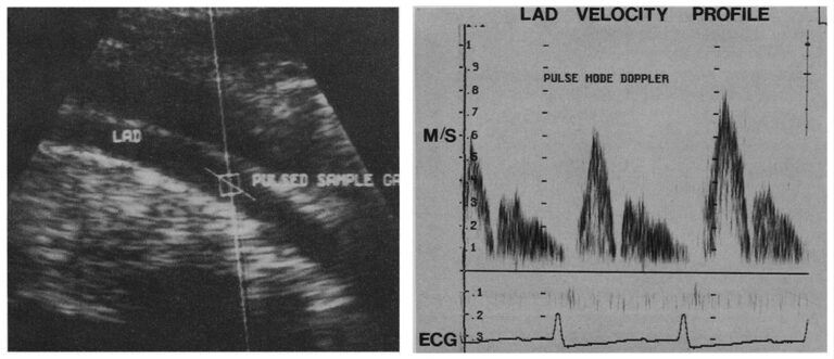 A ECOCARDIOGRAFIA EM CASOS ESPECIAIS – PARTE 1 - Blog Ecope