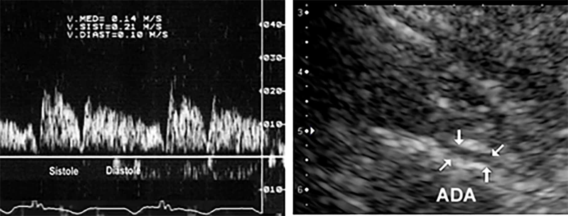 A ECOCARDIOGRAFIA EM CASOS ESPECIAIS – PARTE 1 - Blog Ecope