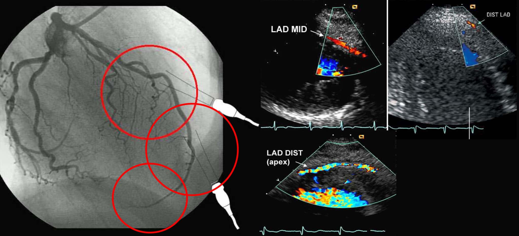 A ECOCARDIOGRAFIA EM CASOS ESPECIAIS – PARTE 1 - Blog Ecope