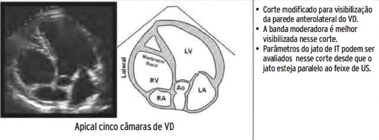 Banda Moderadora: aspectos anatômicos e funcionais - Blog Ecope