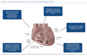Banda Moderadora: aspectos anatômicos e funcionais - Blog Ecope