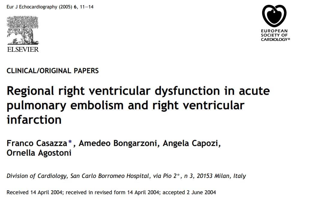60/60 Echo Sign: um marcador de embolia pulmonar - Blog Ecope