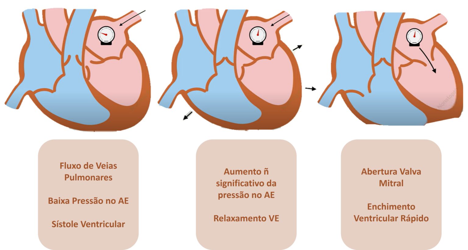 Volume da Fase de Conduto do Átrio Esquerdo e Função Diastólica do ...