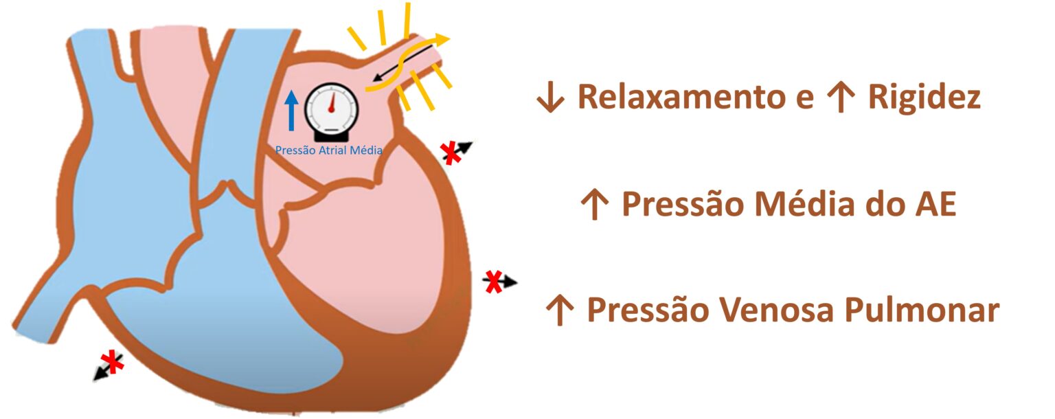 Volume da Fase de Conduto do Átrio Esquerdo e Função Diastólica do ...