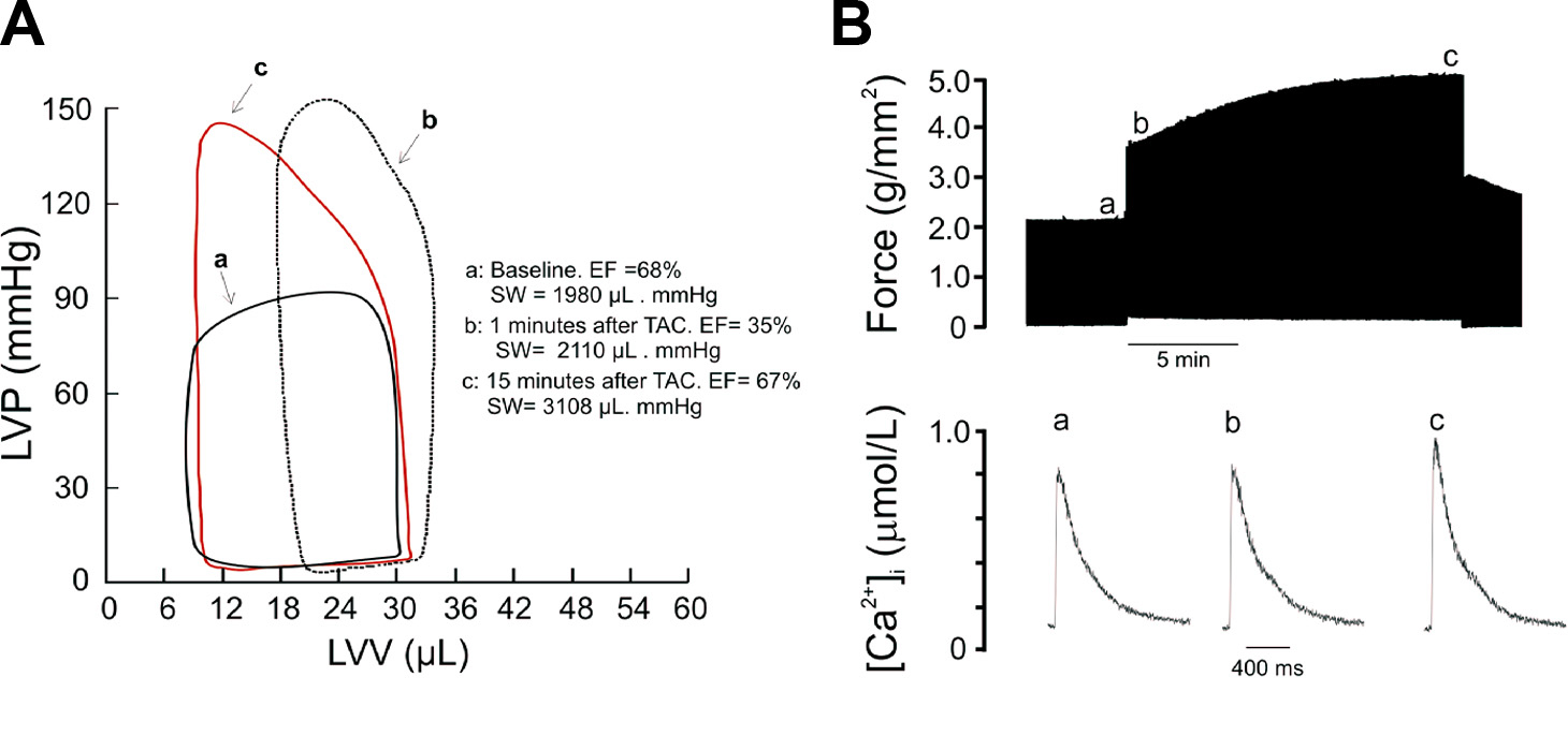 CURIOSIDADES SOBRE FISIOLOGIA CARDÍACA. CONHECE O EFEITO ANREP? - Blog ...